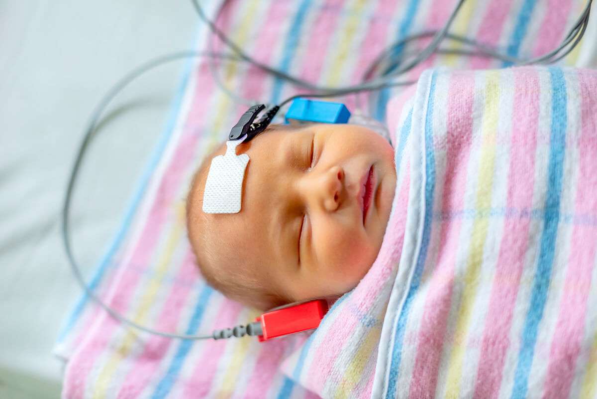 All About Congenital Hearing Loss in Newborns - Berger Henry ENT